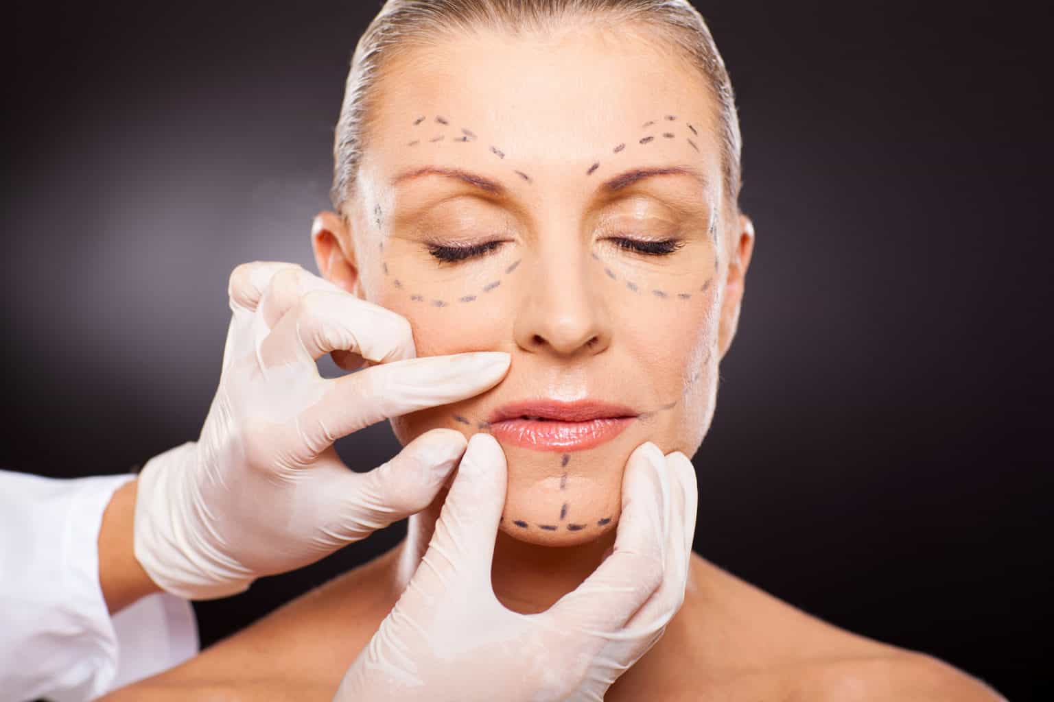 Your Appearance With A Mid Facelift: A Comprehensive Guide